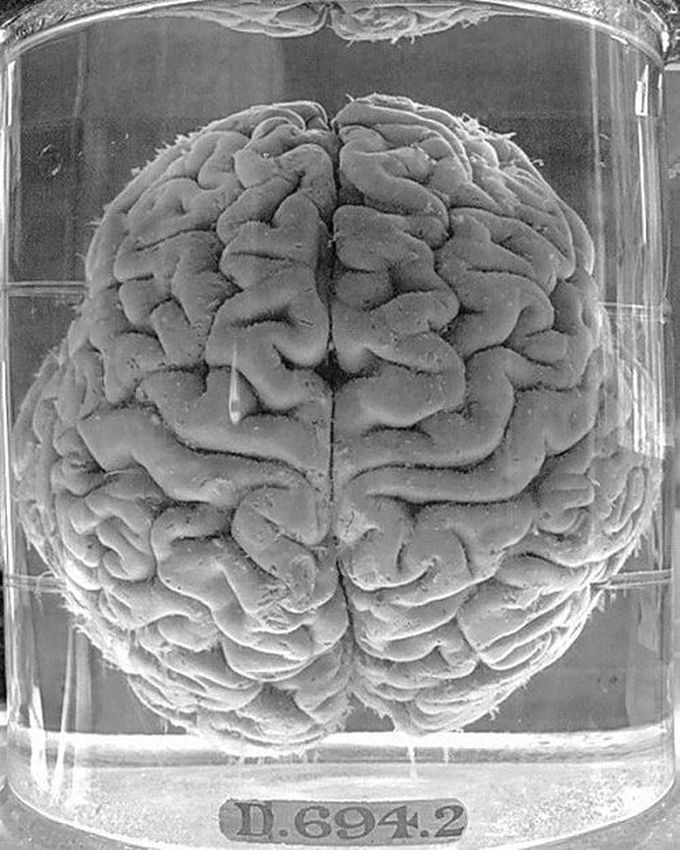 If the human brain was so simple that we could understand - MEDizzy