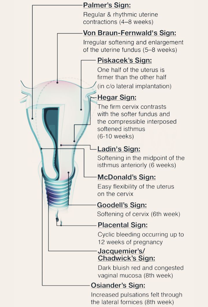 Chadwicks Sign