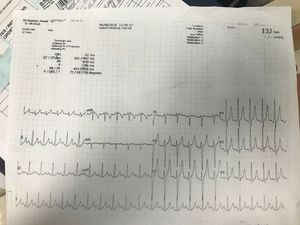 ECG interpretation please - MEDizzy