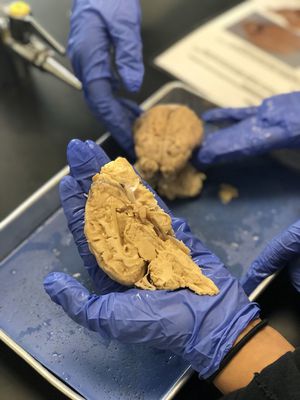 Sheep Brain - MEDizzy