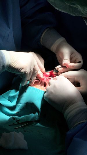 One of todays operation case - MEDizzy