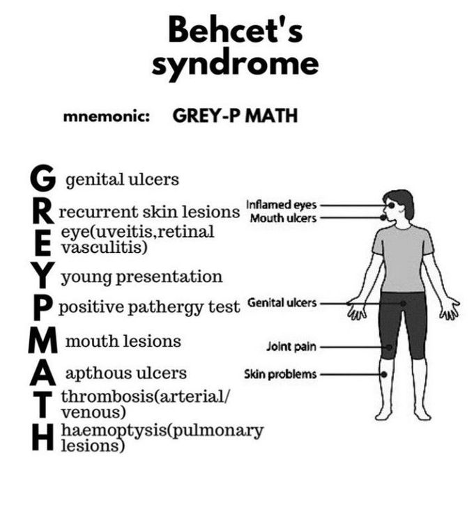 Behcet's Syndrome - MEDizzy