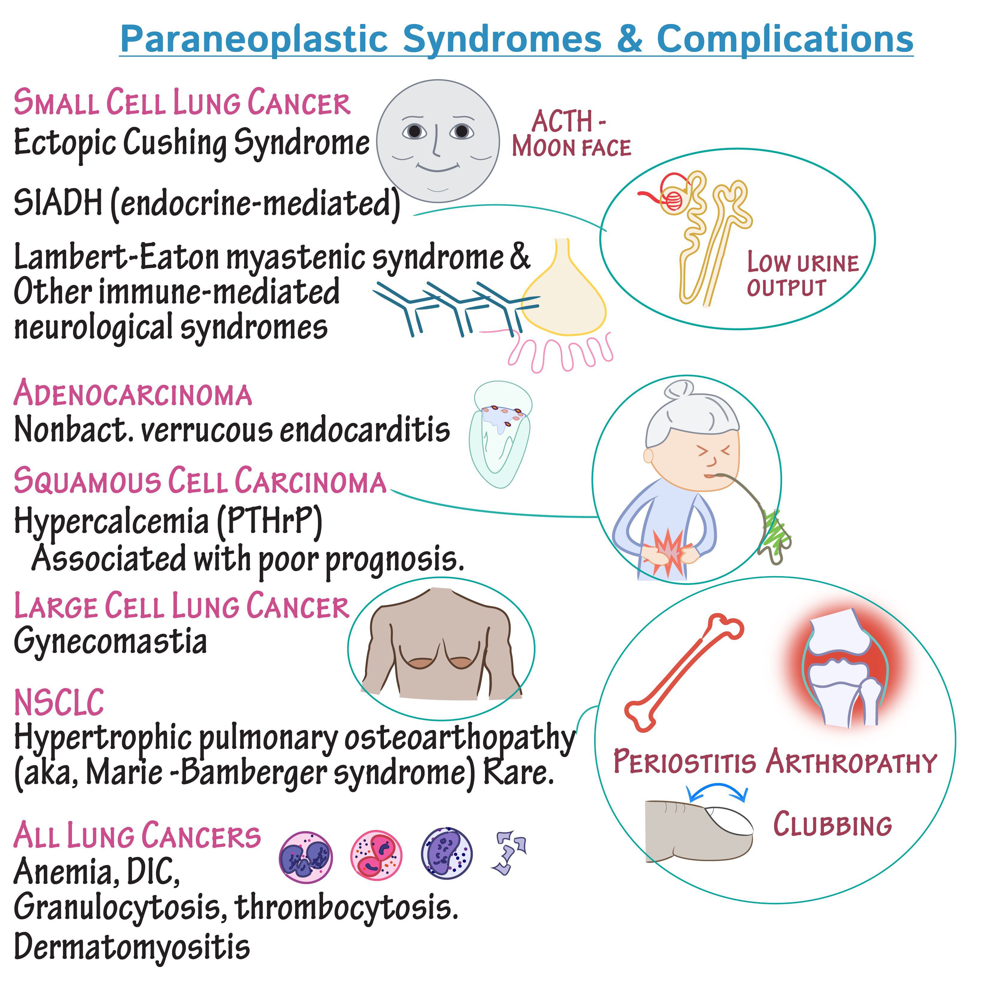 Dermatomyositis Paraneoplastic Syndrome