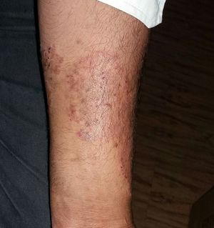 Please diagnose - MEDizzy