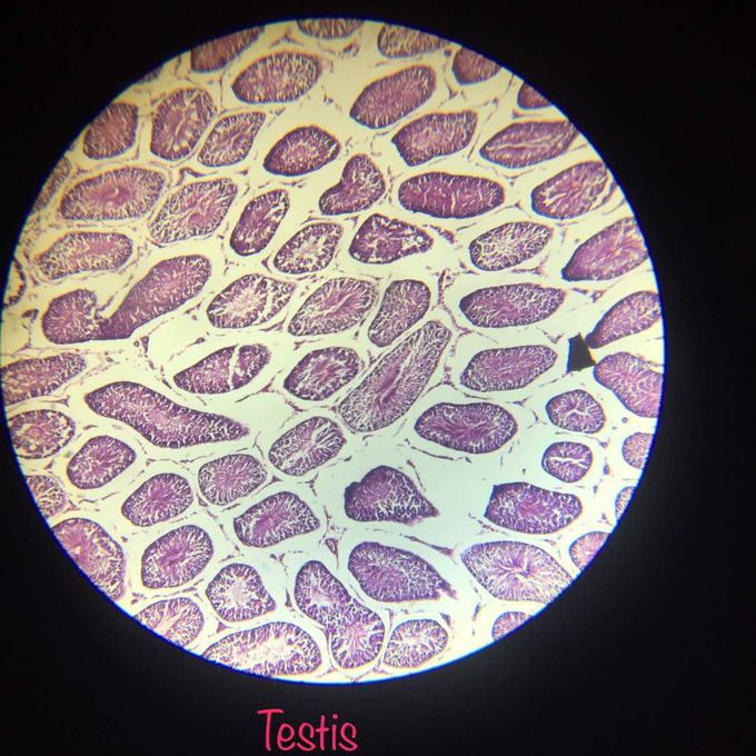 Testis Interstitial Cells