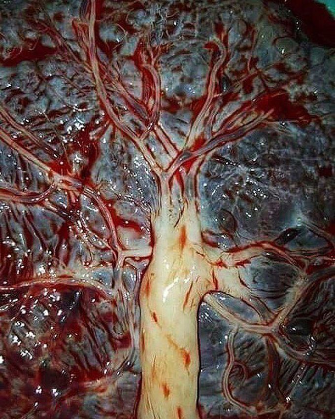 This photo shows it all. The tree of life. The beginning. - MEDizzy