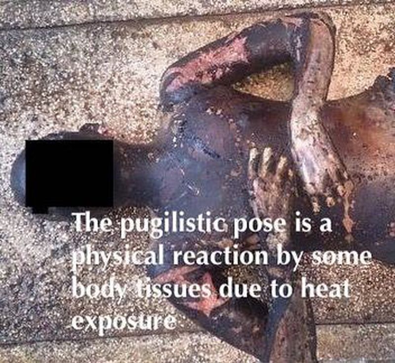 pugilistic stance example