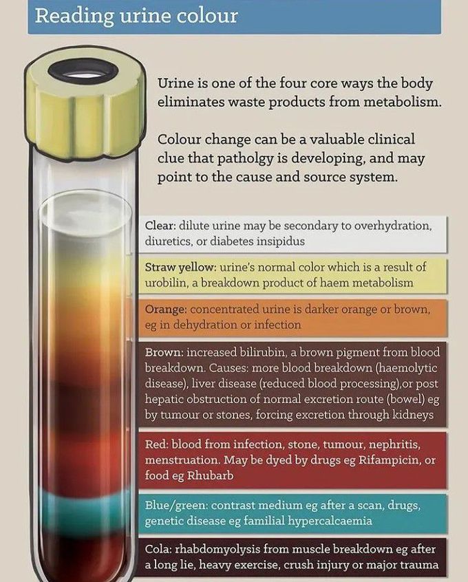 Reading Urine colour - MEDizzy