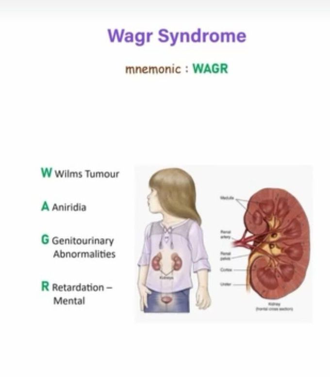 Wagr Syndrome - MEDizzy