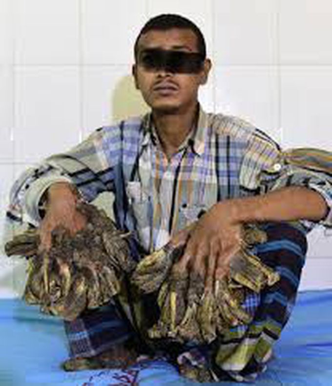 Case study - MEDizzy