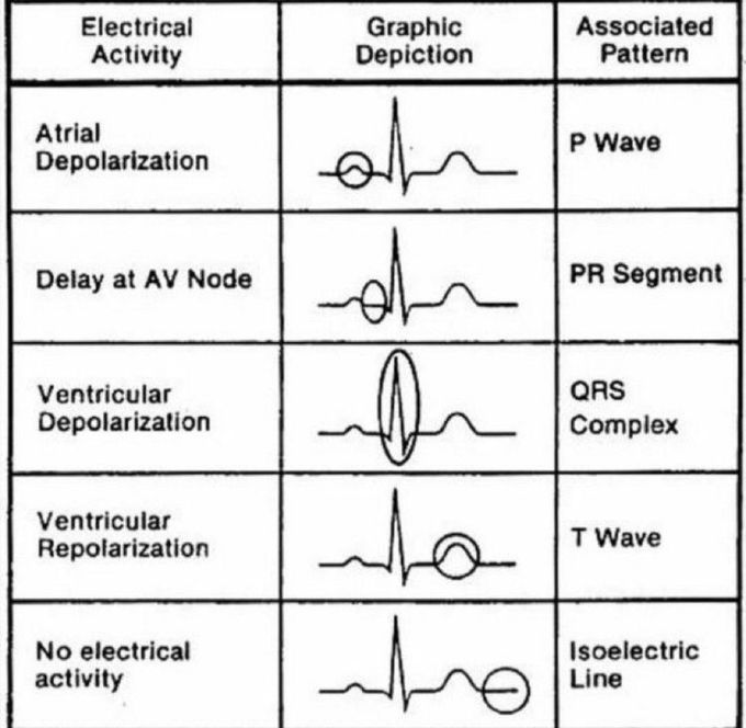 ECG important points - MEDizzy