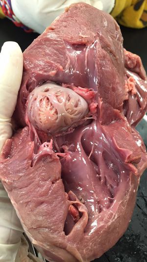 Turning a heart inside out - MEDizzy