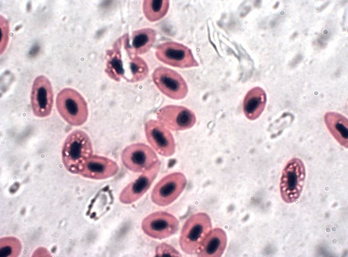 Fish rbc morphology - MEDizzy