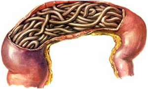 What is the diagnosis? - MEDizzy