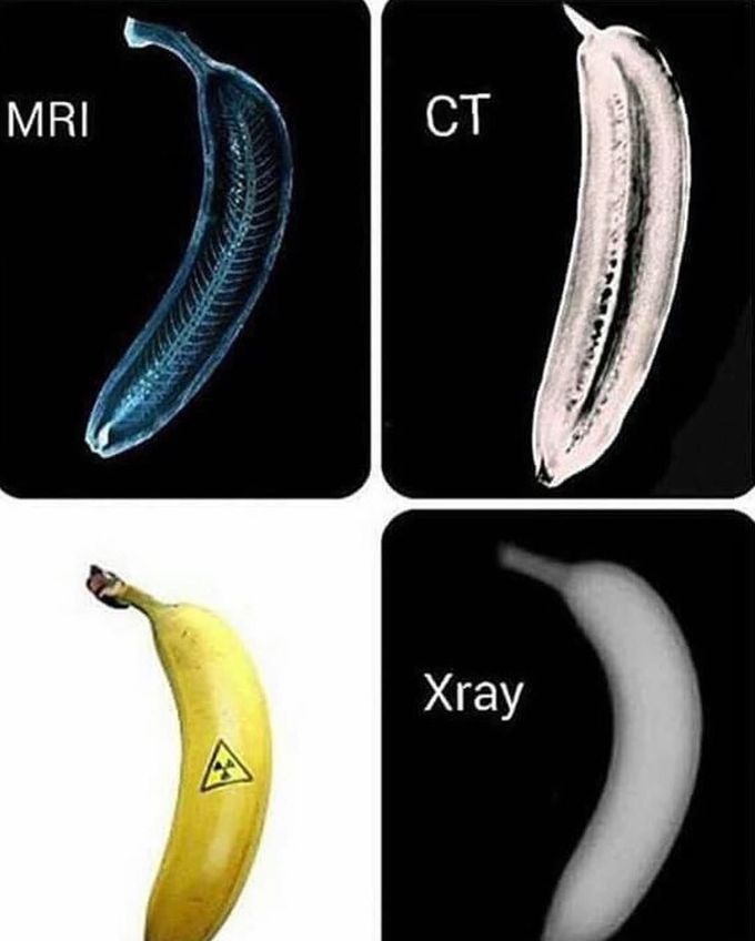 The difference between the images produced by different - MEDizzy