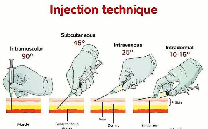 Injection technique - MEDizzy