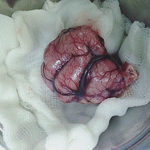 Piece of brain - MEDizzy