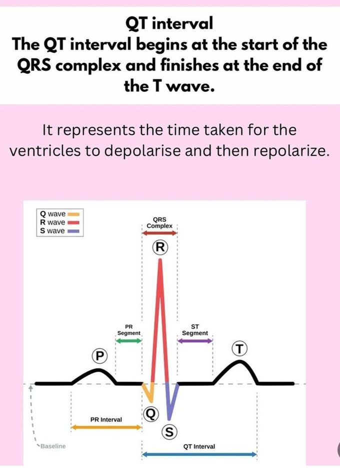 ECG Basics VII - MEDizzy