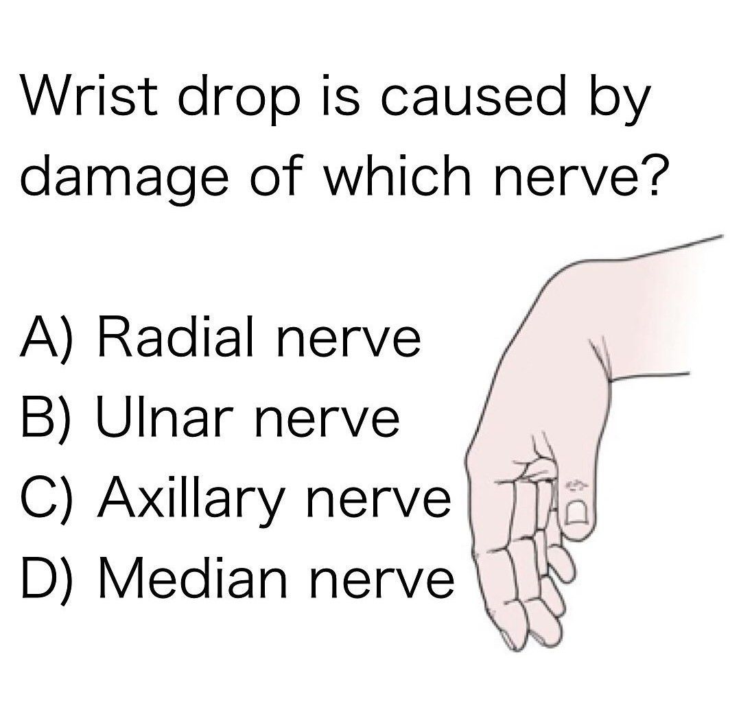 Wrist Drop - MEDizzy