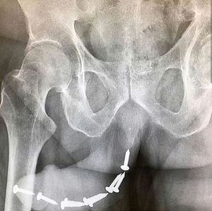 Today we have a very interesting case of foreign body in the - MEDizzy