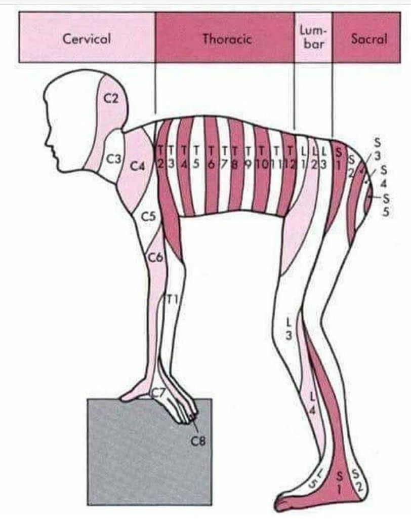 Now it's easier to remember dermaromes. - MEDizzy