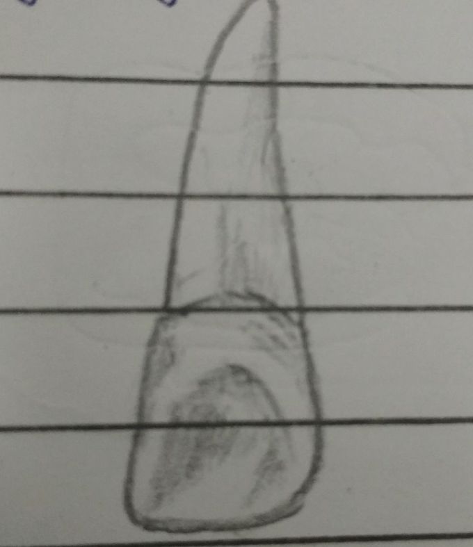 When professor tells you to draw a lateral incisor in file - MEDizzy