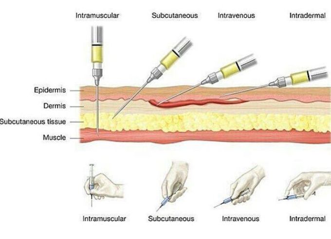 Types of injections - MEDizzy
