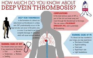 Post number 1179106 - MEDizzy
