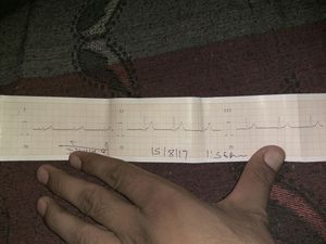 What's problem? - MEDizzy