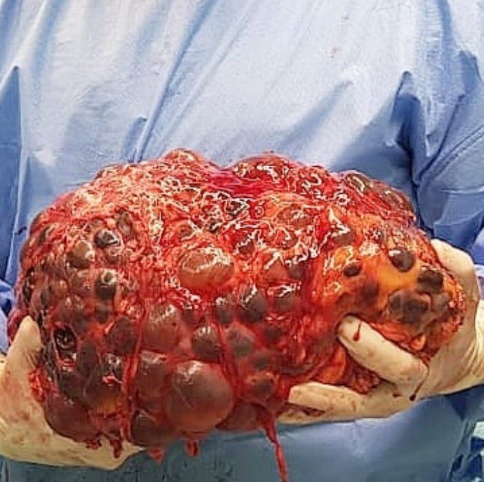 General surgery - MEDizzy