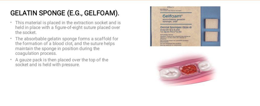 PostOp Bleeding - Gelatin Sponge - MEDizzy