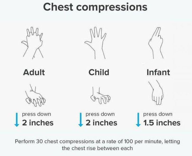Chest Compressions - MEDizzy