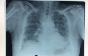 Any 3 spot Diagnosis ? - MEDizzy