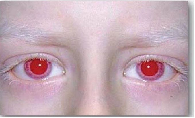 Diagnosis?????? - MEDizzy