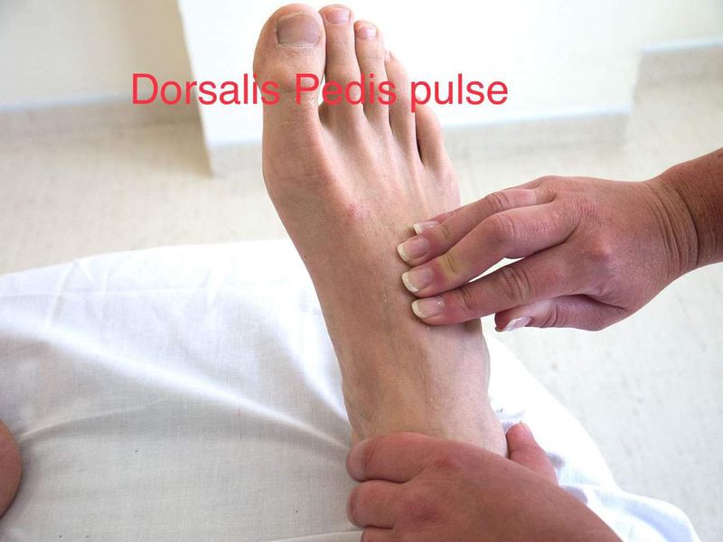 Dorsal pedis side of taking pulse - MEDizzy