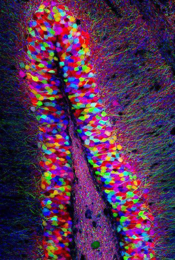 'Brainbow' - MEDizzy