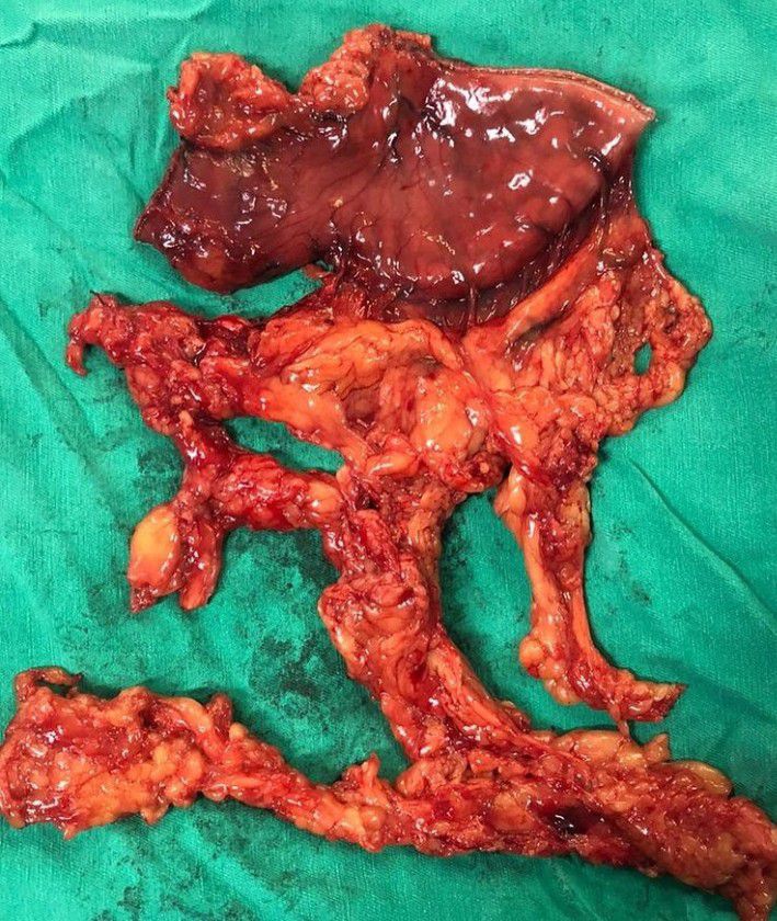 General surgery - MEDizzy