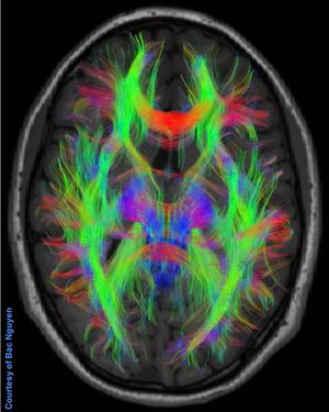 Diffusion Tensor Imaging (DTI) @ Siemens 3T - MEDizzy