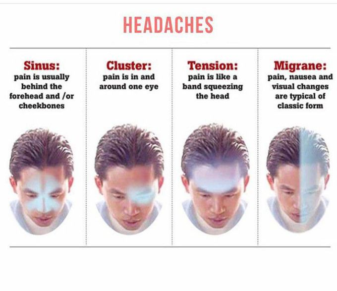 Types of headache - MEDizzy