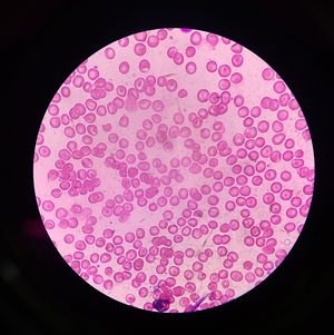 Morphology of rbc - MEDizzy