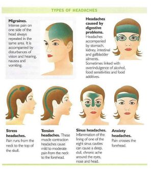 Different types of Headache - MEDizzy