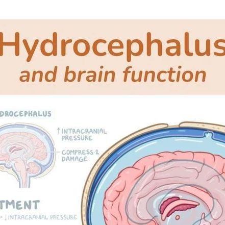 Brain disease - MEDizzy
