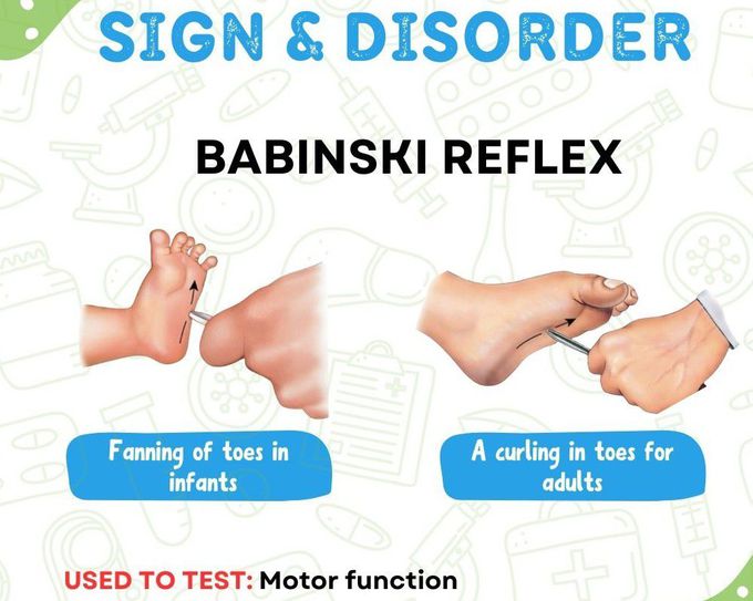 Babinski Reflex In Adults