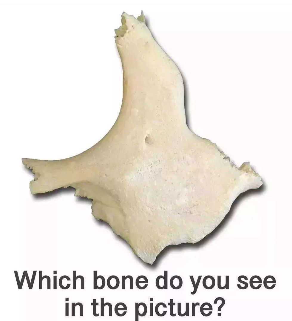Identify the Bone - MEDizzy