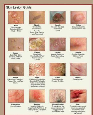 Skin lesions guide - MEDizzy