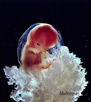 SEM (Scanning electron micrograph) of a 10 weeks old embryo - MEDizzy