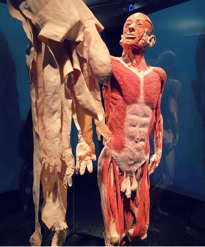 Human anatomy - MEDizzy