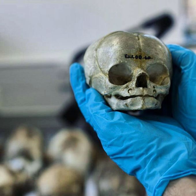 A new study published in the Journal of Anatomy and based on - MEDizzy