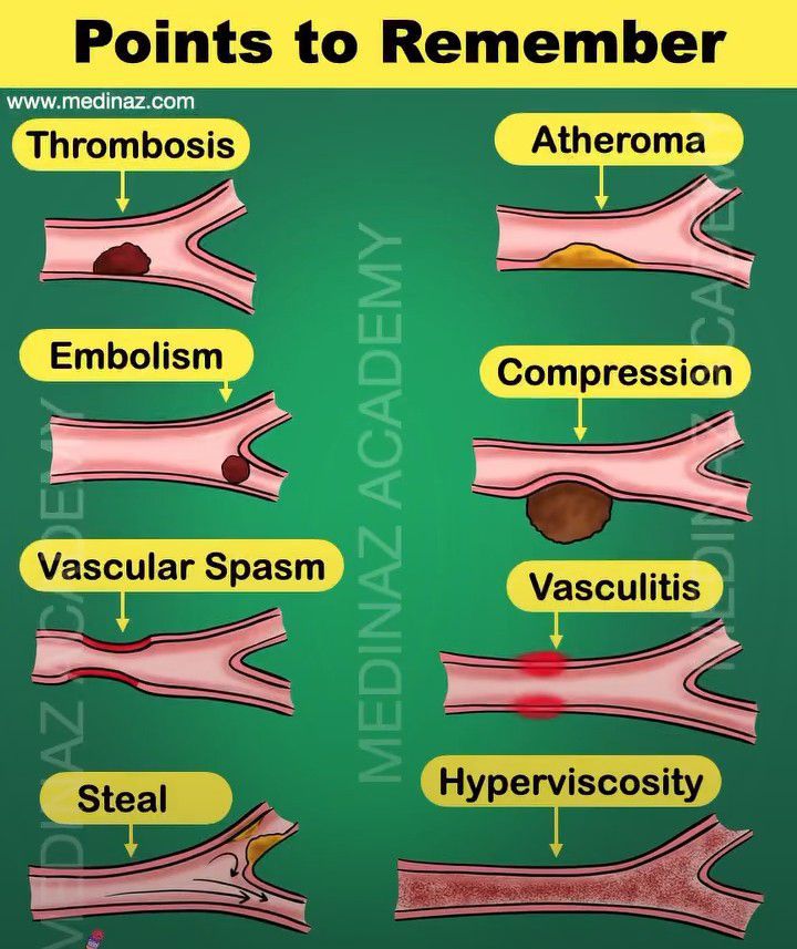 Points to Remember - MEDizzy