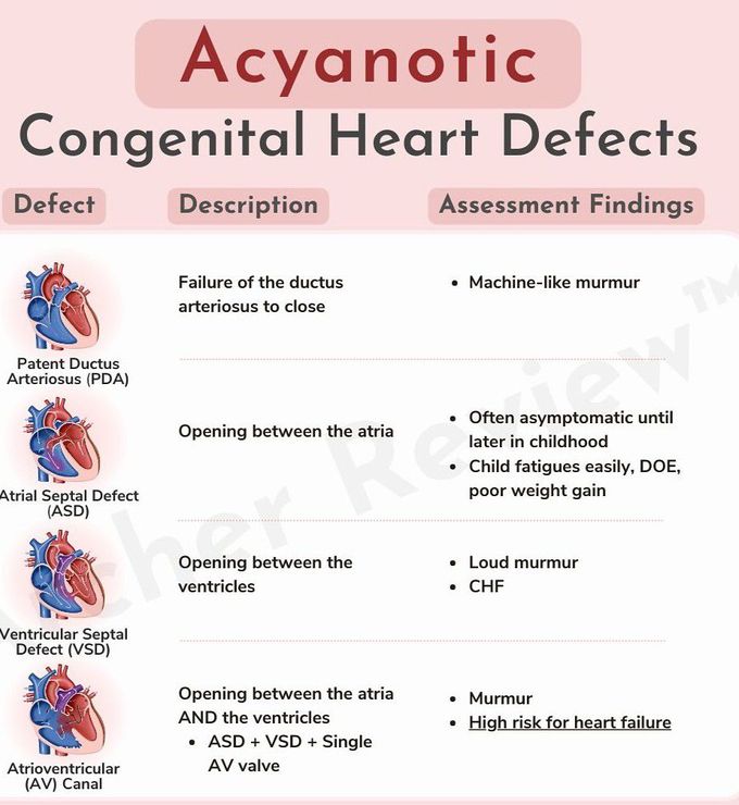 Acynotic Congenital Heart Defect - MEDizzy
